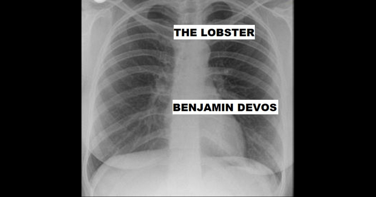 THE LOBSTER by Benjamin DeVos | X-R-A-Y