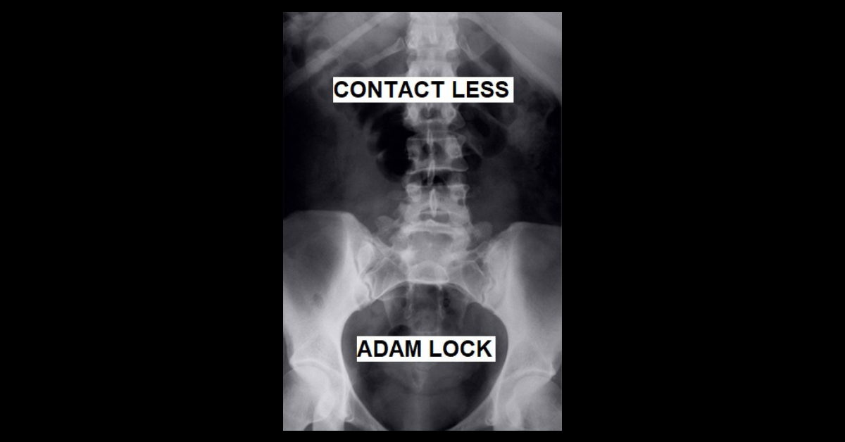 CONTACT LESS by Adam Lock | X-R-A-Y