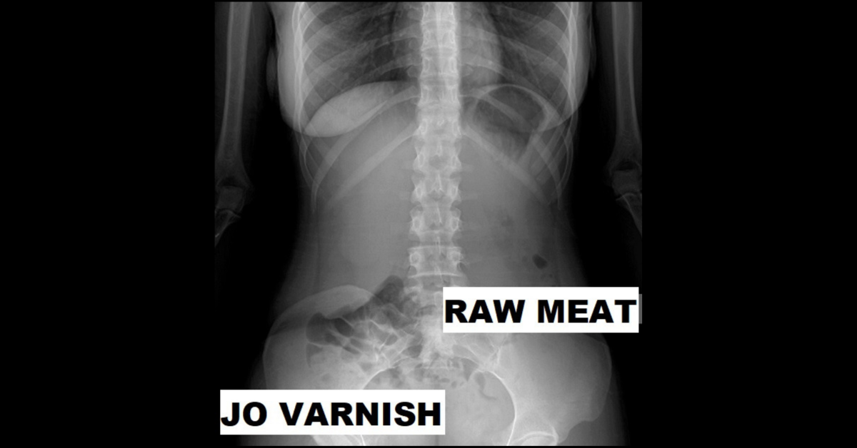 RAW MEAT by Jo Varnish | X-R-A-Y